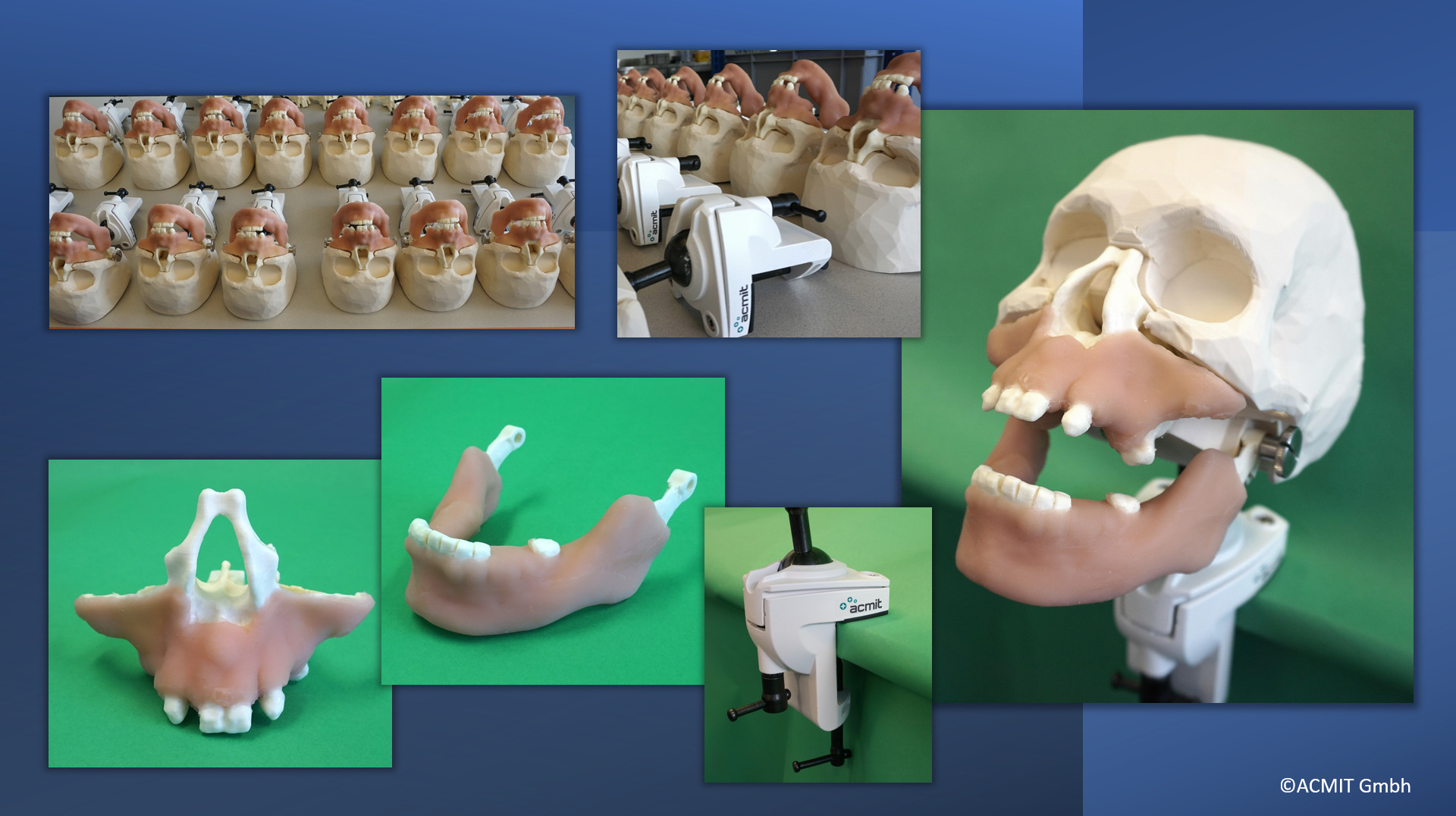 DentoSkull™, the implantology training model for augmentative surgery ...